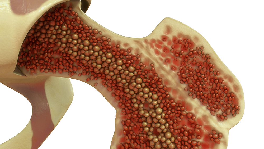 Bone marrow - Bioscience Today